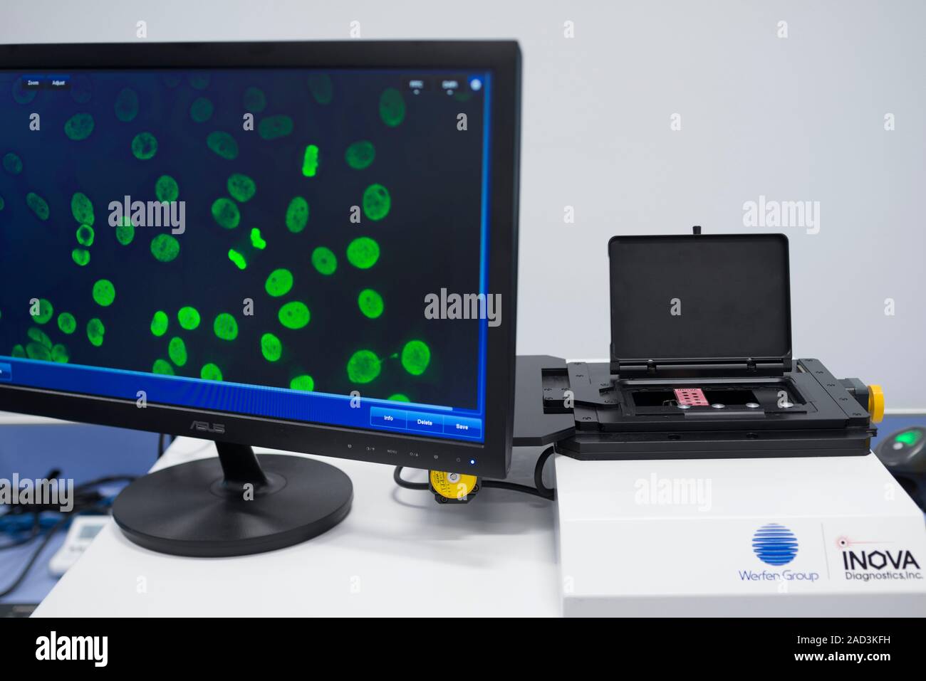 Nova View automated pathology microscope. Nova View automated ...