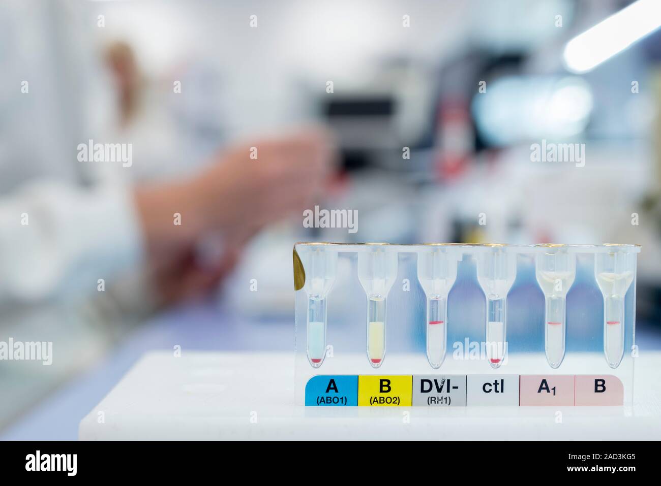 Blood group analysis. Close-up of a test kit used to determine a ...