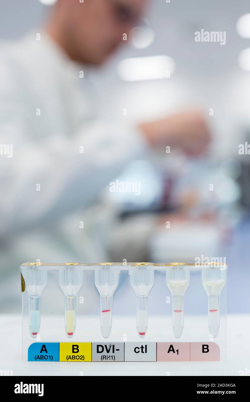 Blood group analysis. Close-up of a test kit used to determine a ...