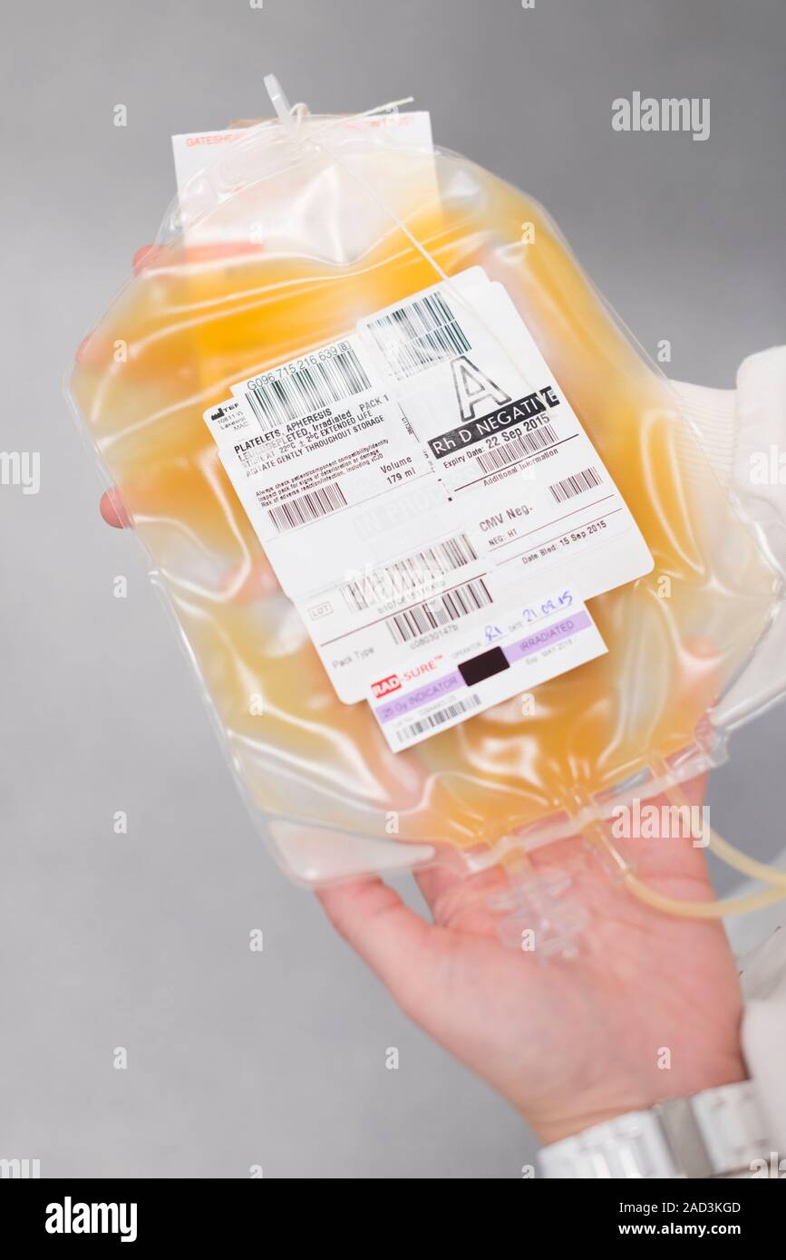 Donated blood platelets. Haematologist holding a bag of type A Negative ...
