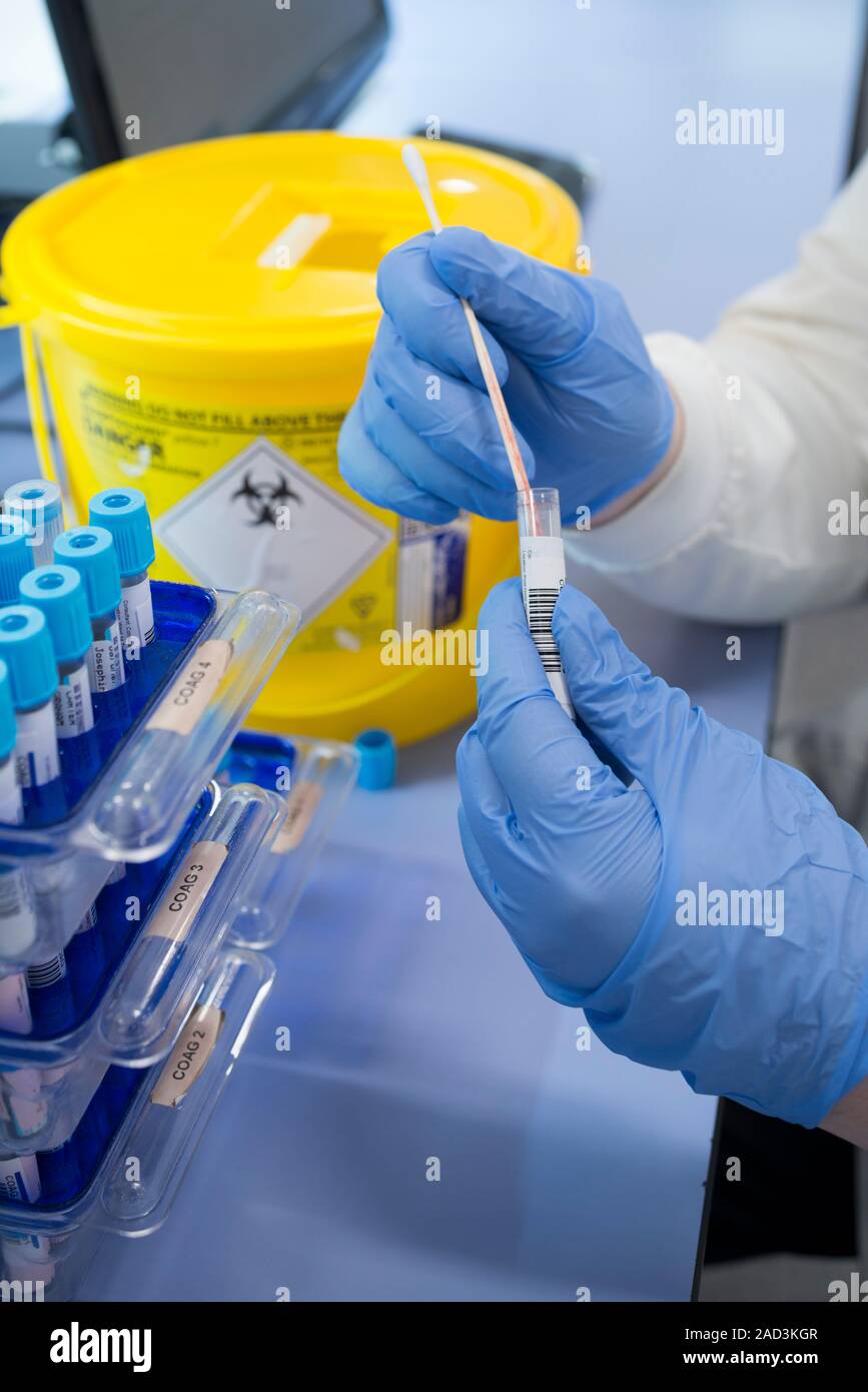 Haematology laboratory. Haematologist preparing blood samples for ...