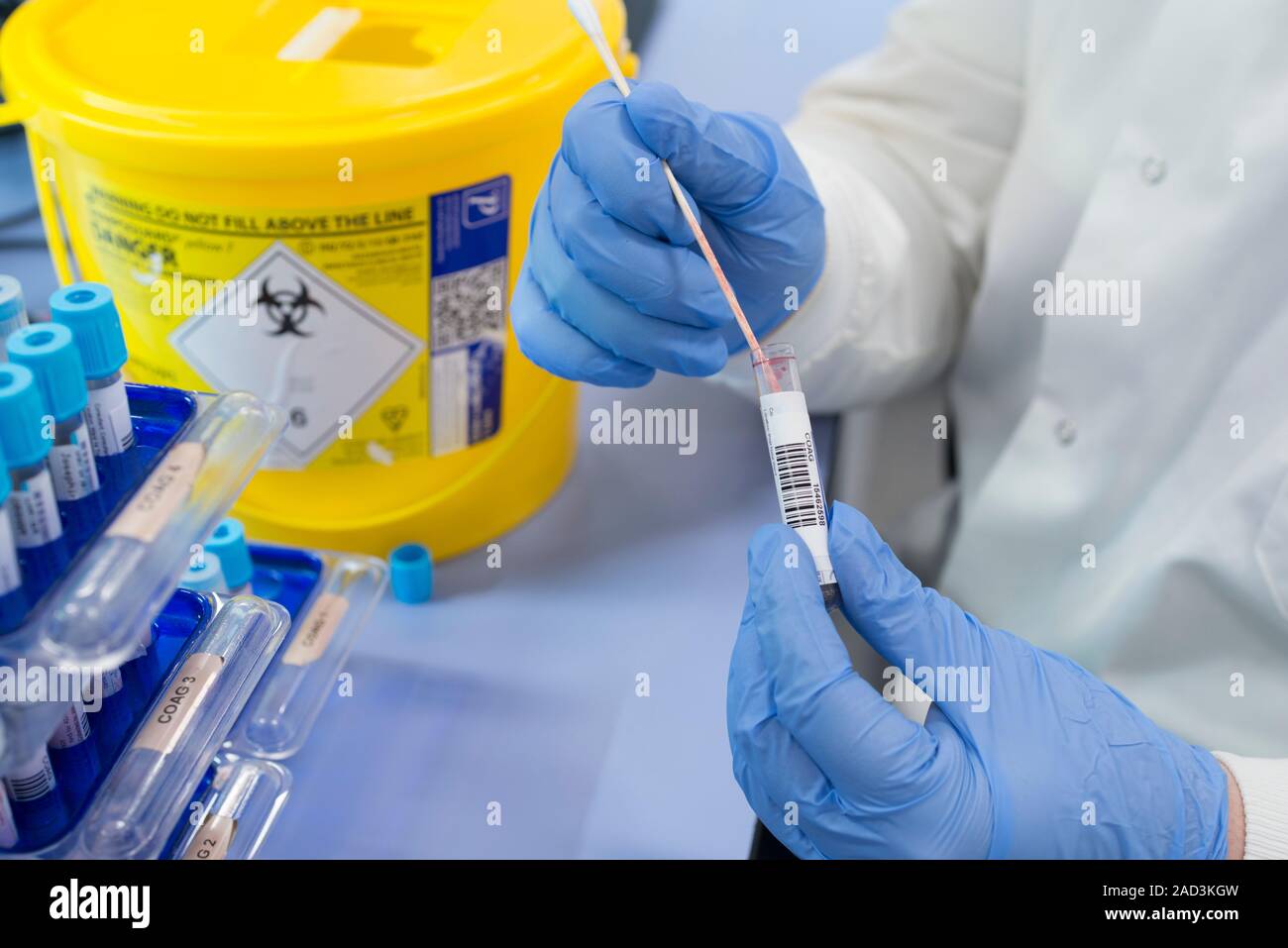Haematology laboratory. Haematologist preparing blood samples for ...