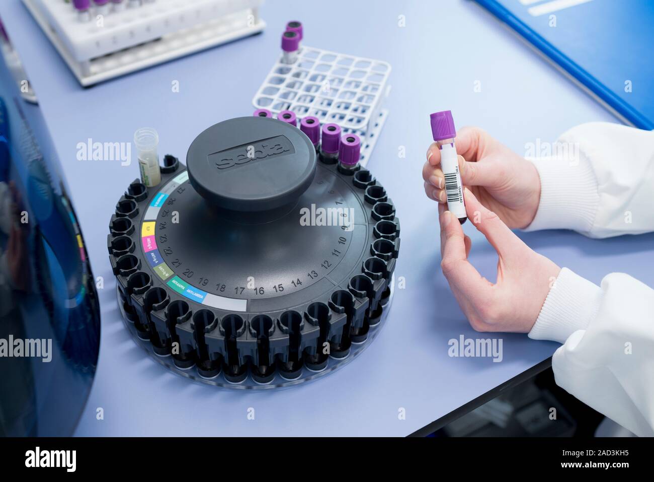 Haematology laboratory. Haematologist preparing blood samples for ...