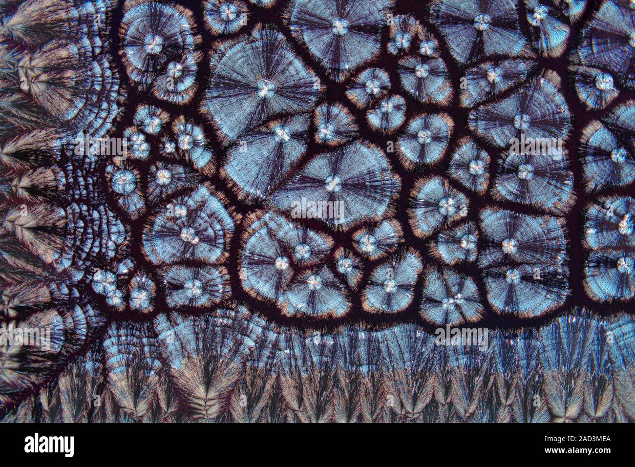 Cholesterol crystals. Polarized light micrograph of crystals of the ...