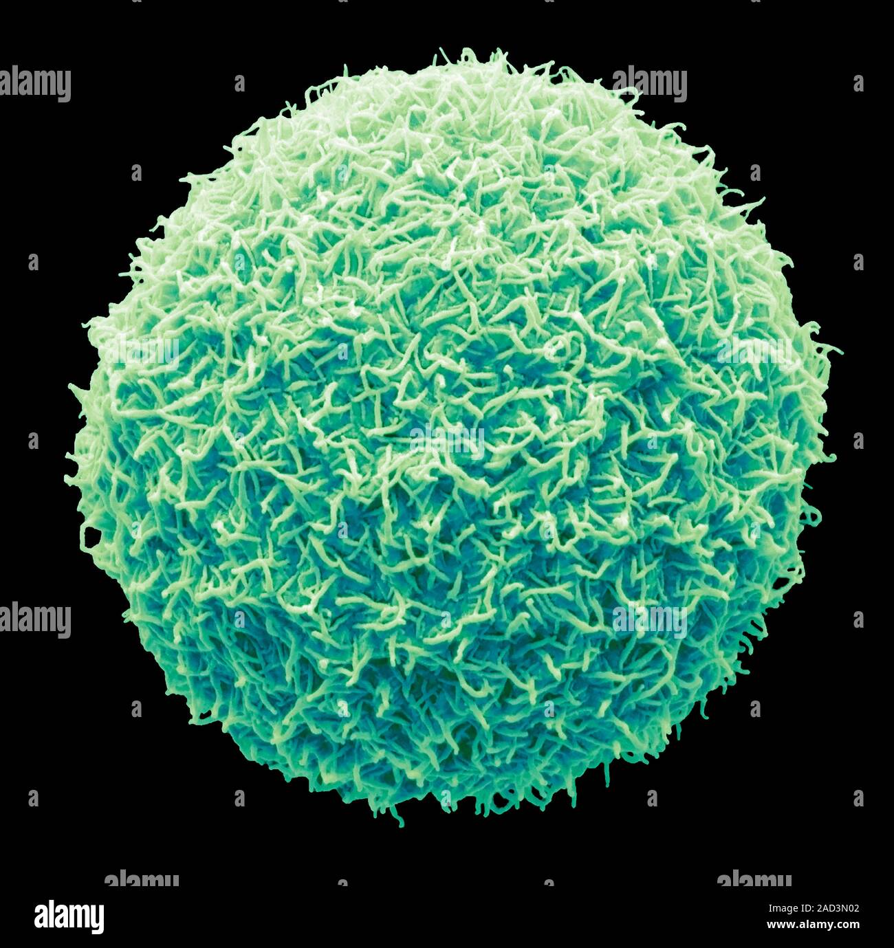 Freshwater alga. Coloured scanning electron micrograph (SEM). The term ...