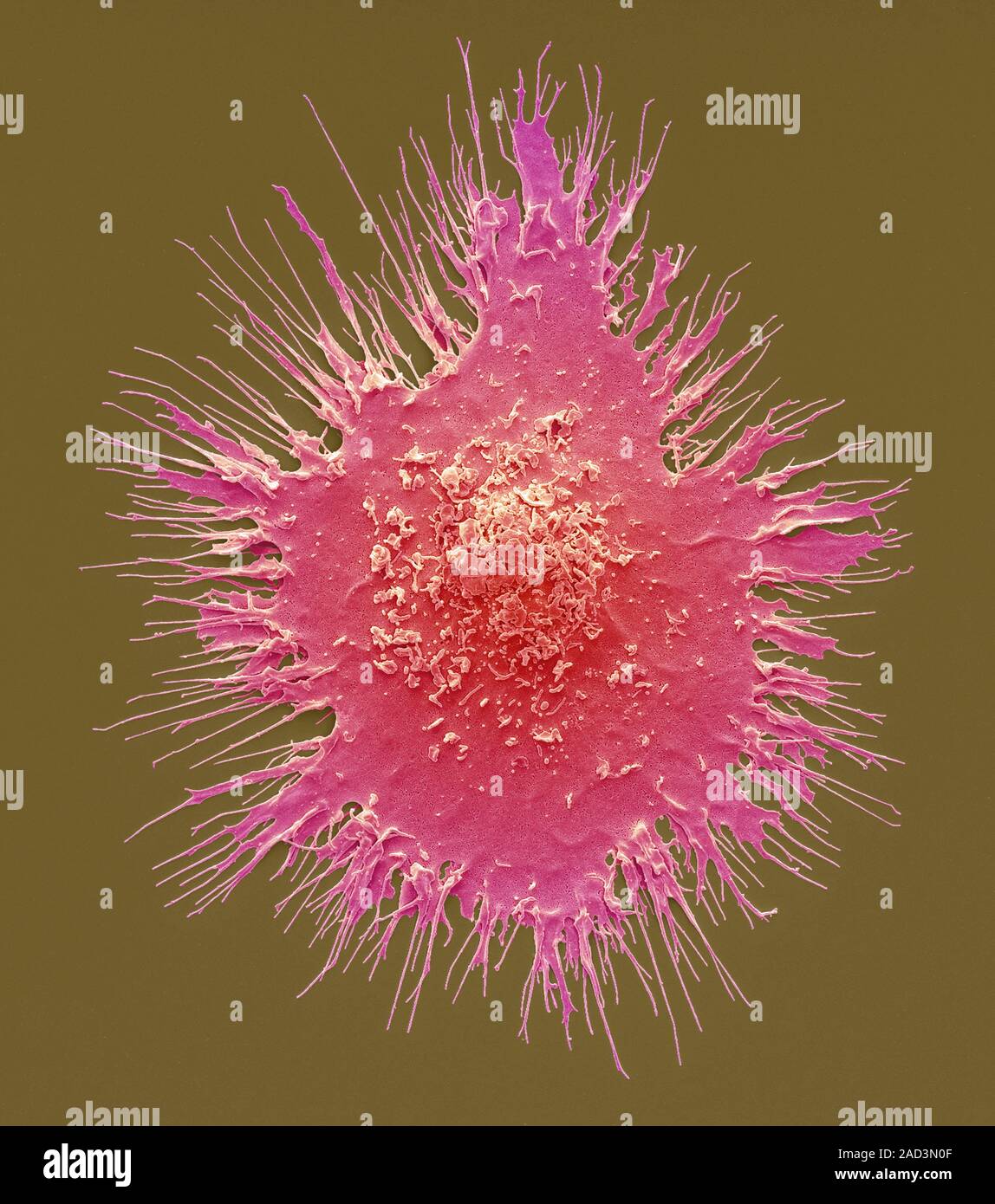 Dendritic cell. Coloured scanning electron micrograph (SEM) of a ...