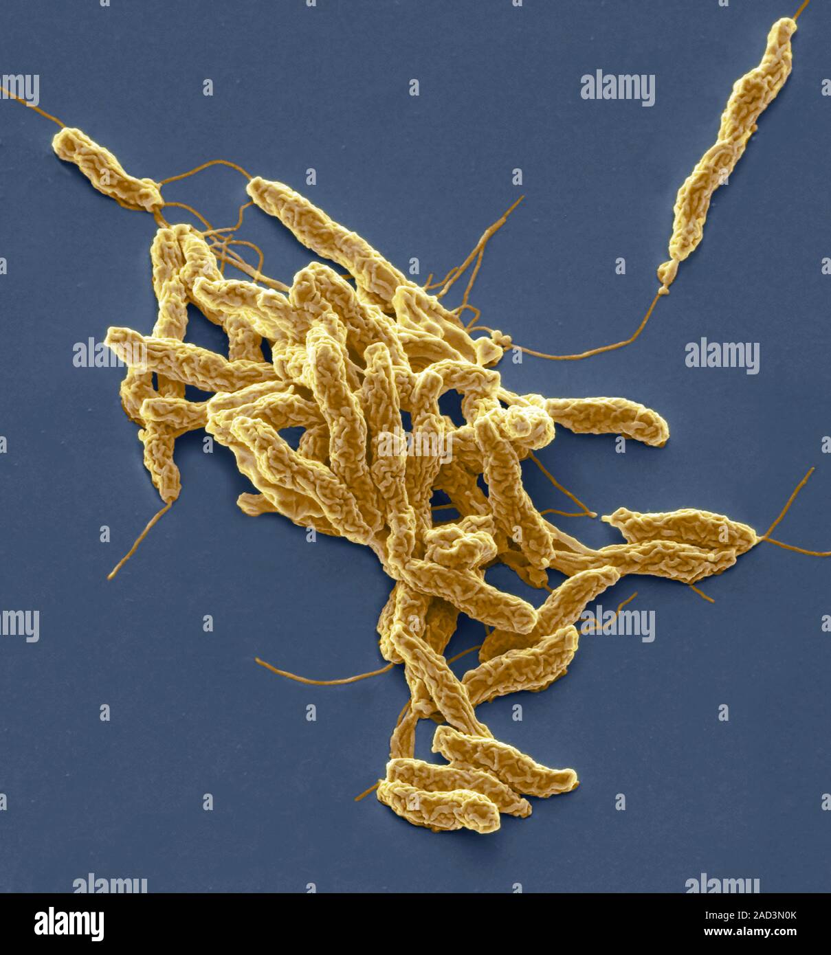 Campylobacter jejuni bacteria. Coloured scanning electron micrograph ...