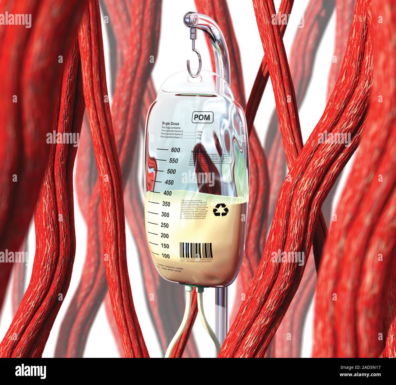 Muscle wastage in intensive care, conceptual illustration. An ...