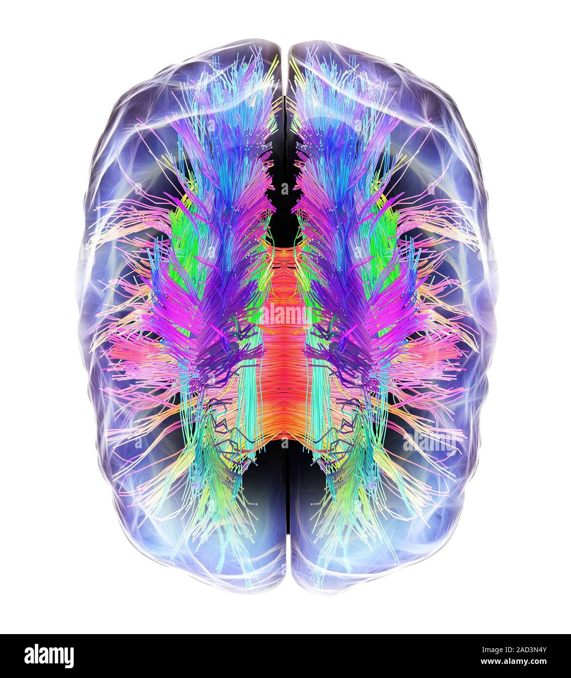 White matter fibres overlaid a 3d model of the human brain in top view. Coloured 3D diffusion ...