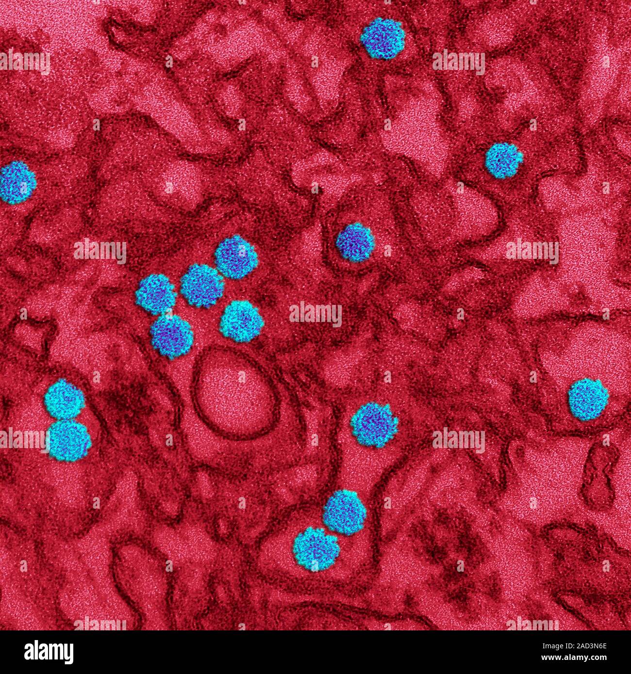 Coloured transmission electron micrograph (TEM) of Zika virus particles ...