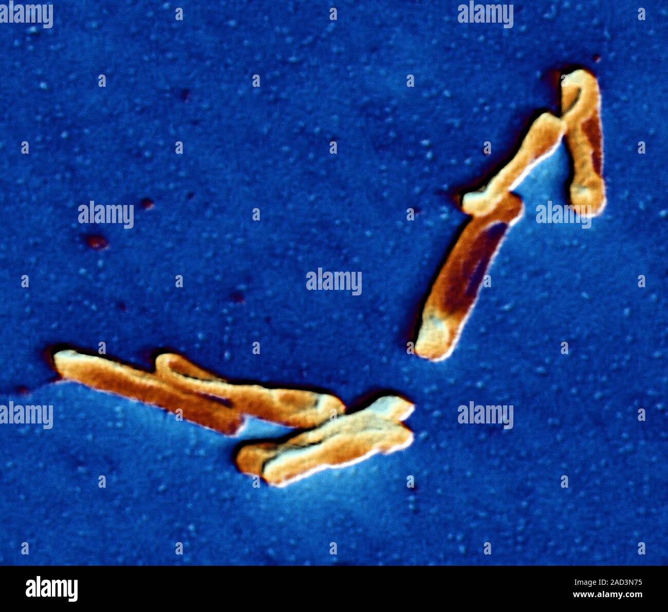 Clostridium Difficile Bacteria Coloured Transmission Electron Micrograph Tem These Rod