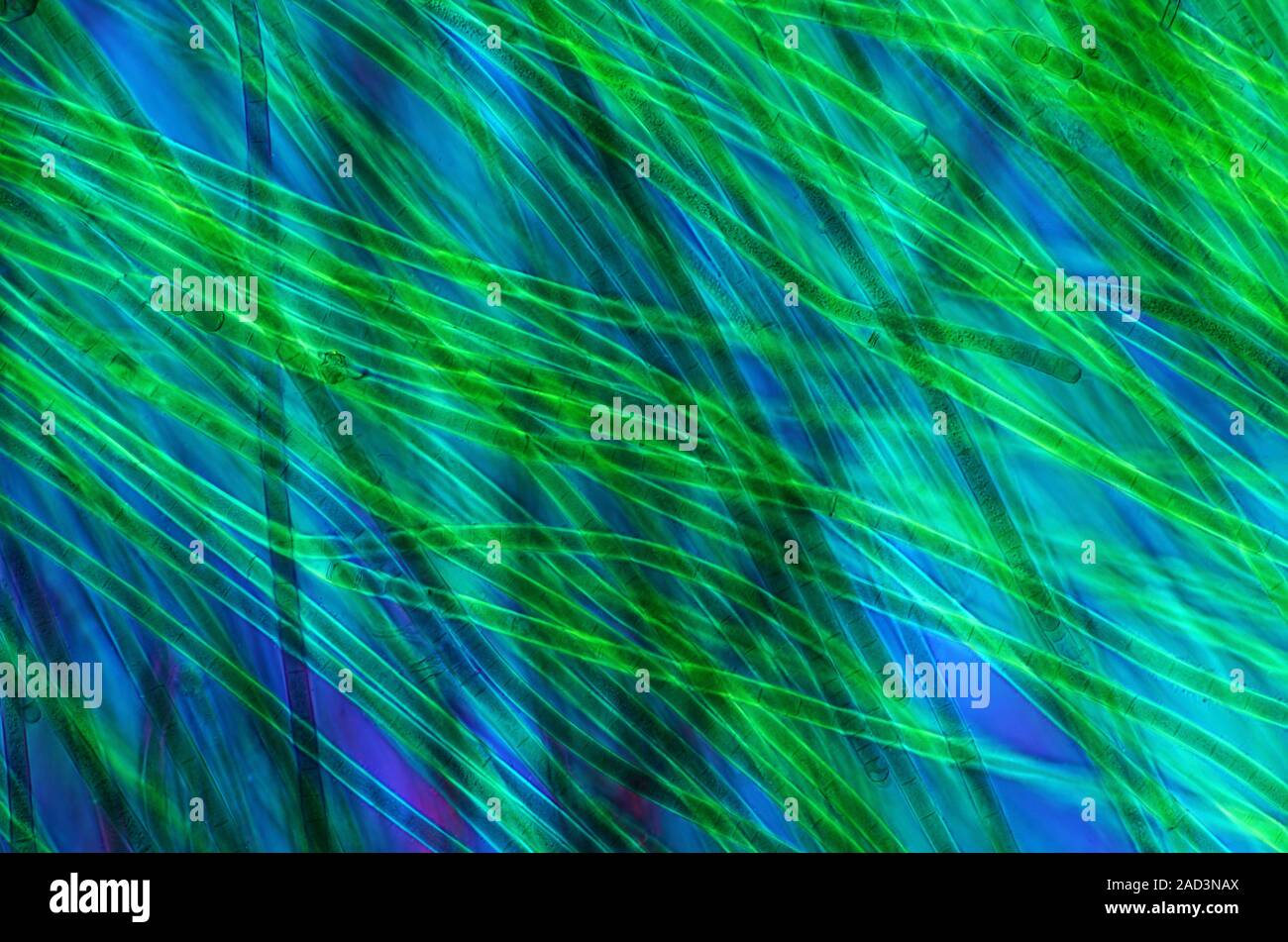 Cyanobacteria. Polarised light micrograph of filamentous cyanobacteria ...