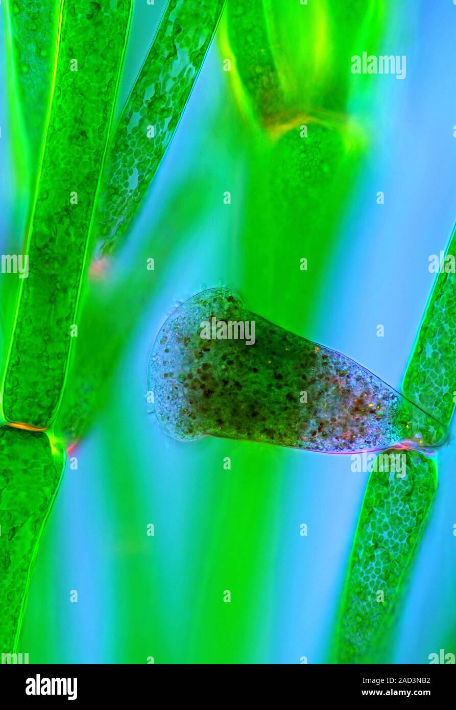 Protozoan on green algae. Polarised light micrograph of a Suctoria sp ...