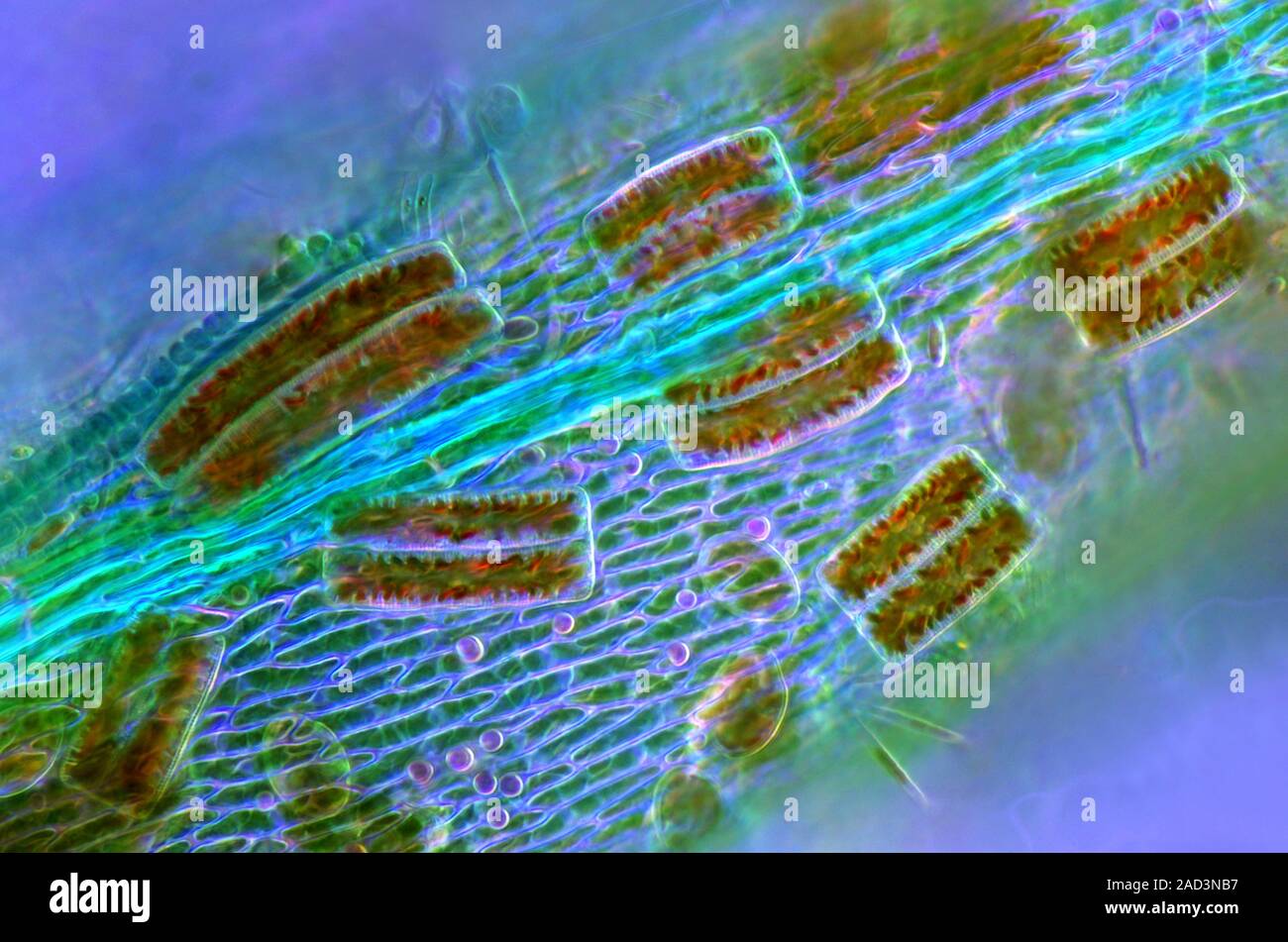 Epithemia diatoms. Polarised light micrograph of Epithemia sp. diatoms ...