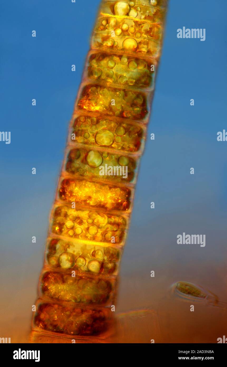 Melosira diatoms. Polarised light micrograph of a colony of Melosira sp ...