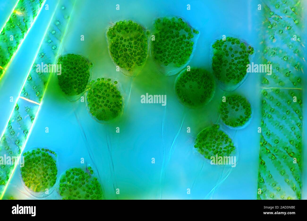Vorticella protozoa. Polarised light micrograph of Vorticella sp ... Vorticella protozoa. Polarised light micrograph of Vorticella sp ...