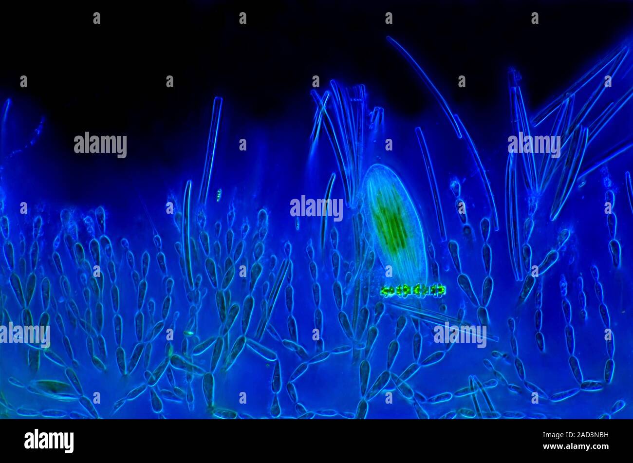 Diatoms and red algae. Darkfield illuminated polarised light micrograph ...