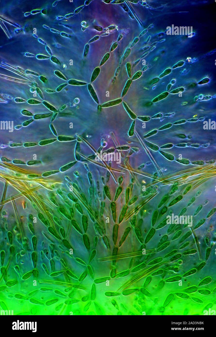 Diatoms and red algae. Darkfield illuminated polarised light micrograph ...