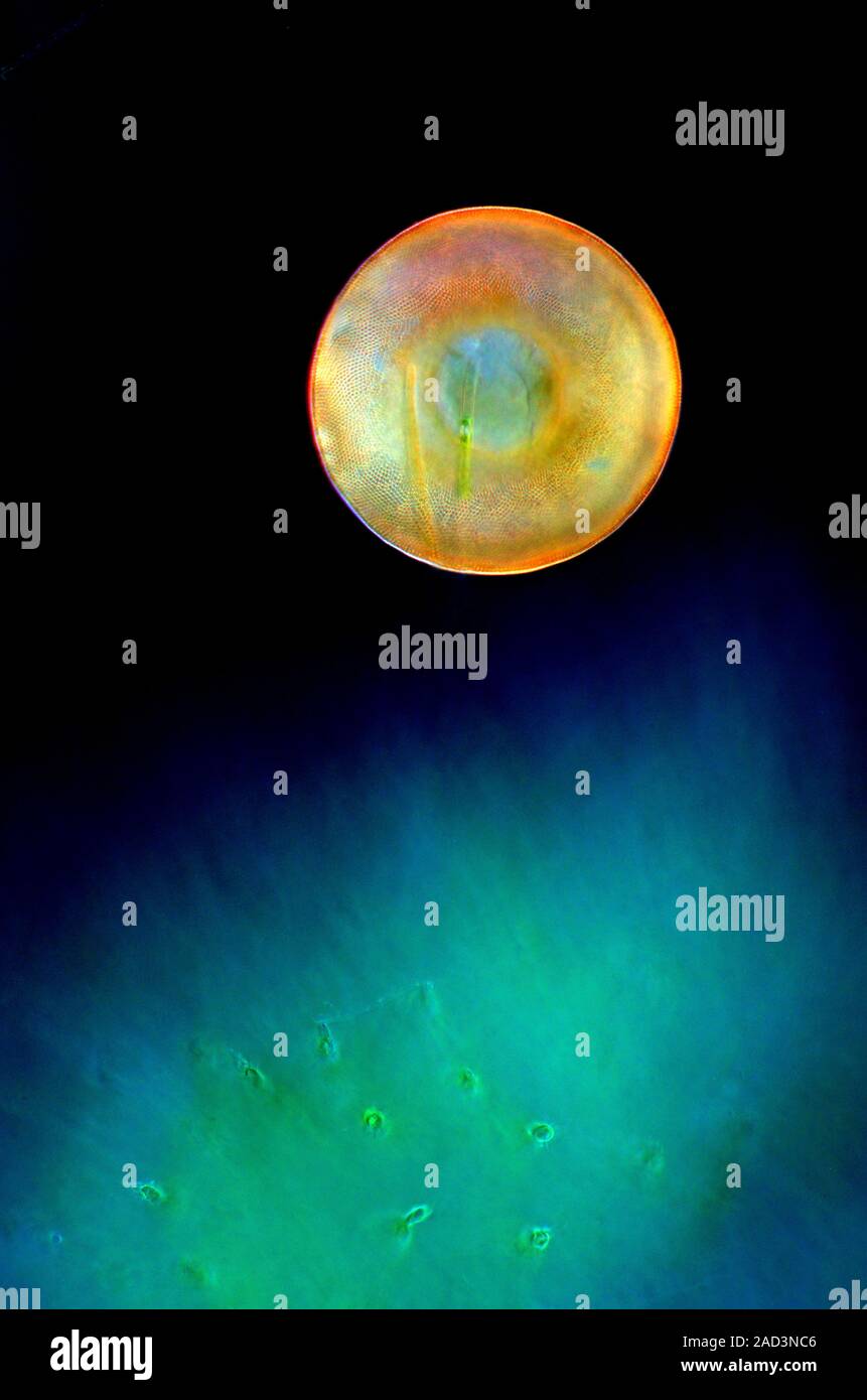 Shelled amoeba. Darkfield illuminated polarised light micrograph of an ...