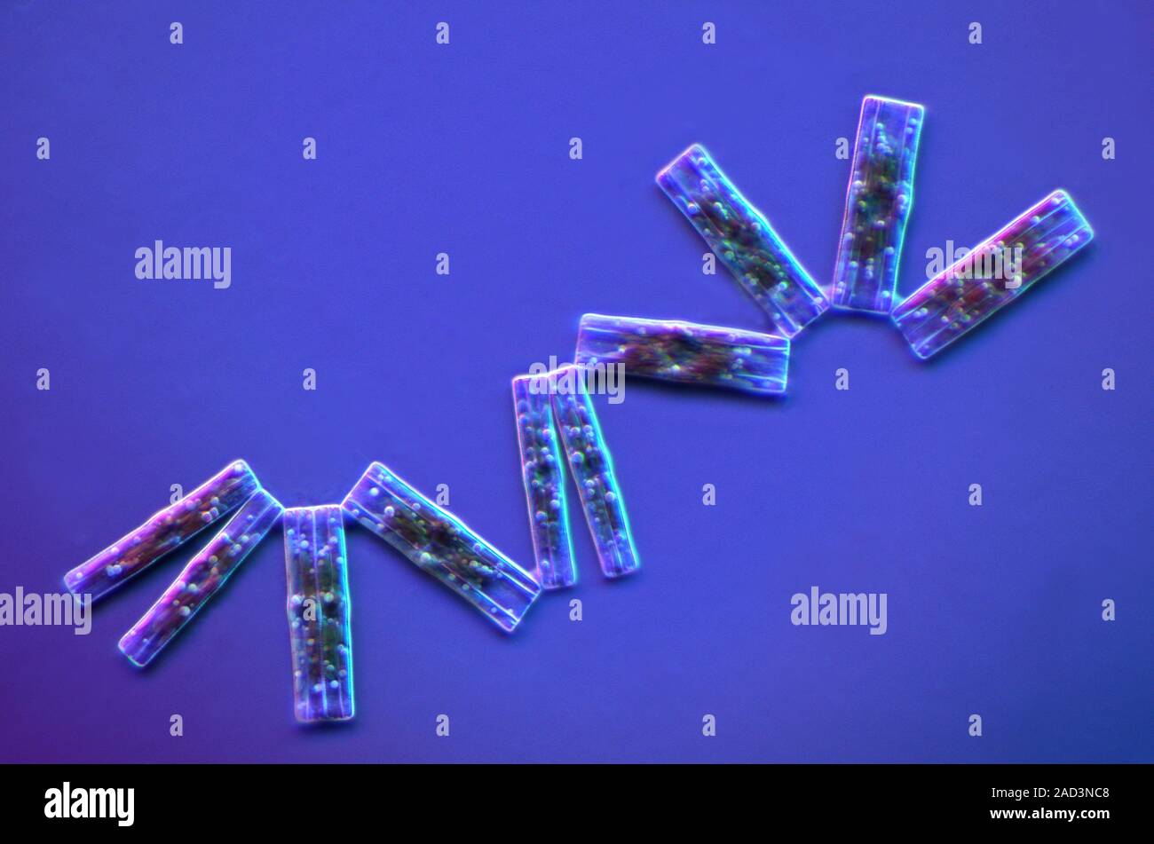 Diatoma diatoms. Polarised light micrograph of a Diatoma sp. diatoms ...