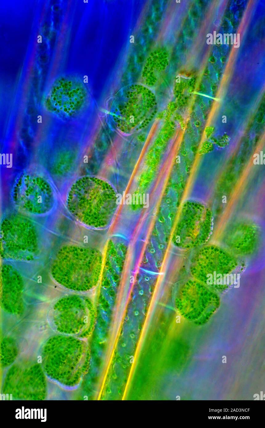 Diatoms and Spirogyra algae. Darkfield illuminated polarised light ...