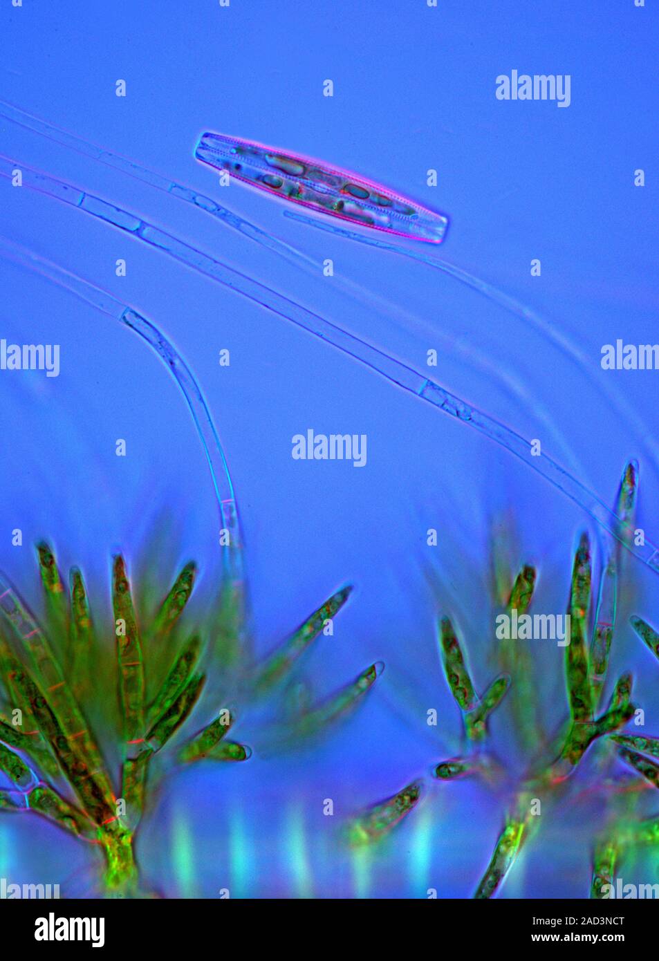 Diatom and green algae. Polarised light micrograph of a Navicula sp ...
