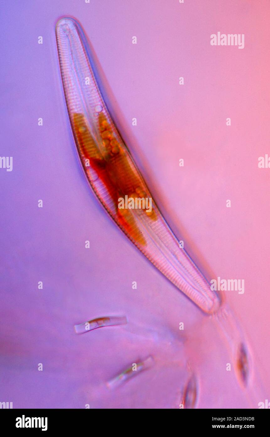 Cymbella diatom. Polarised light micrograph of a Cymbella sp. diatom ...