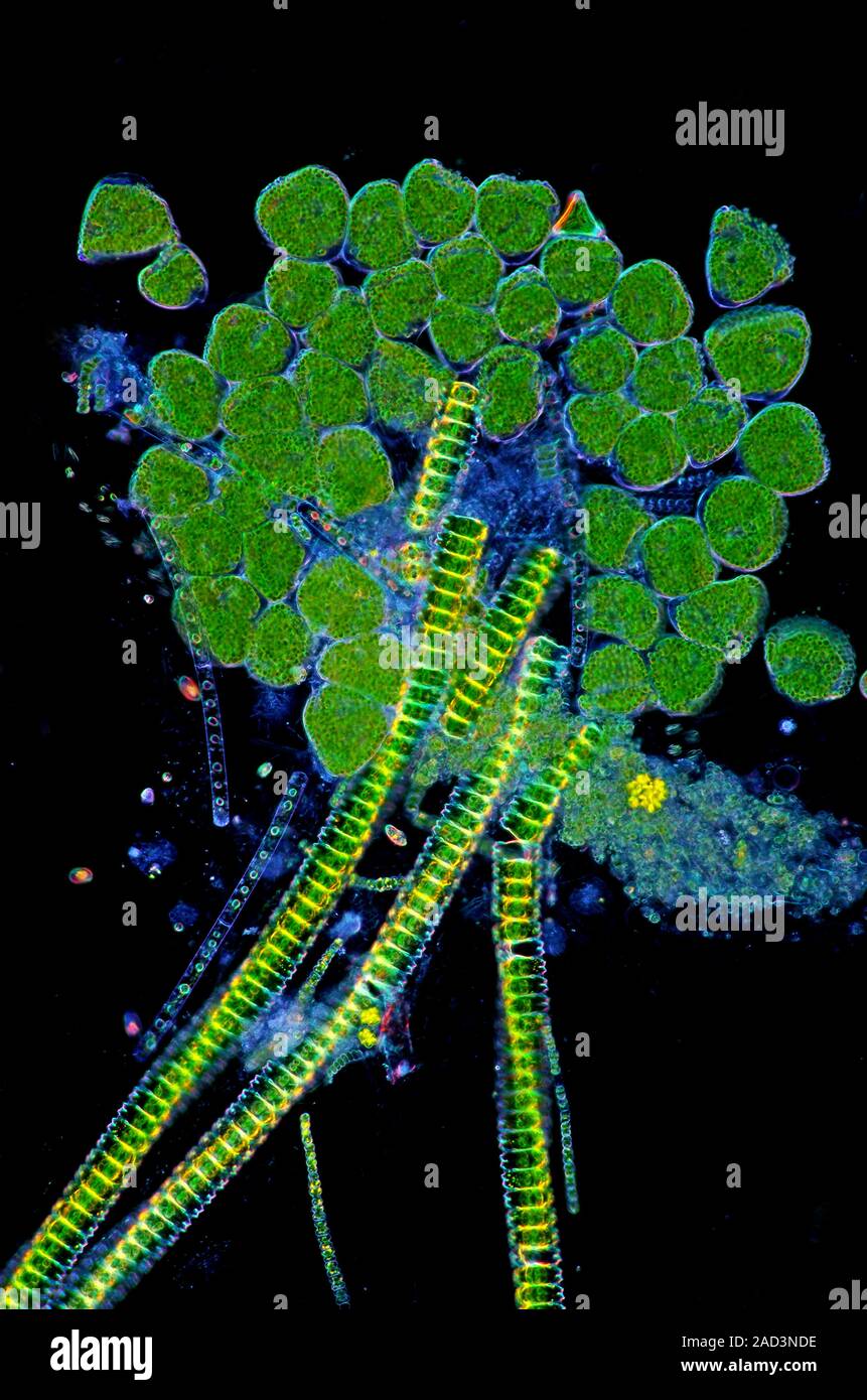 Protozoa and desmids. Darkfield illuminated polarised light micrograph ...