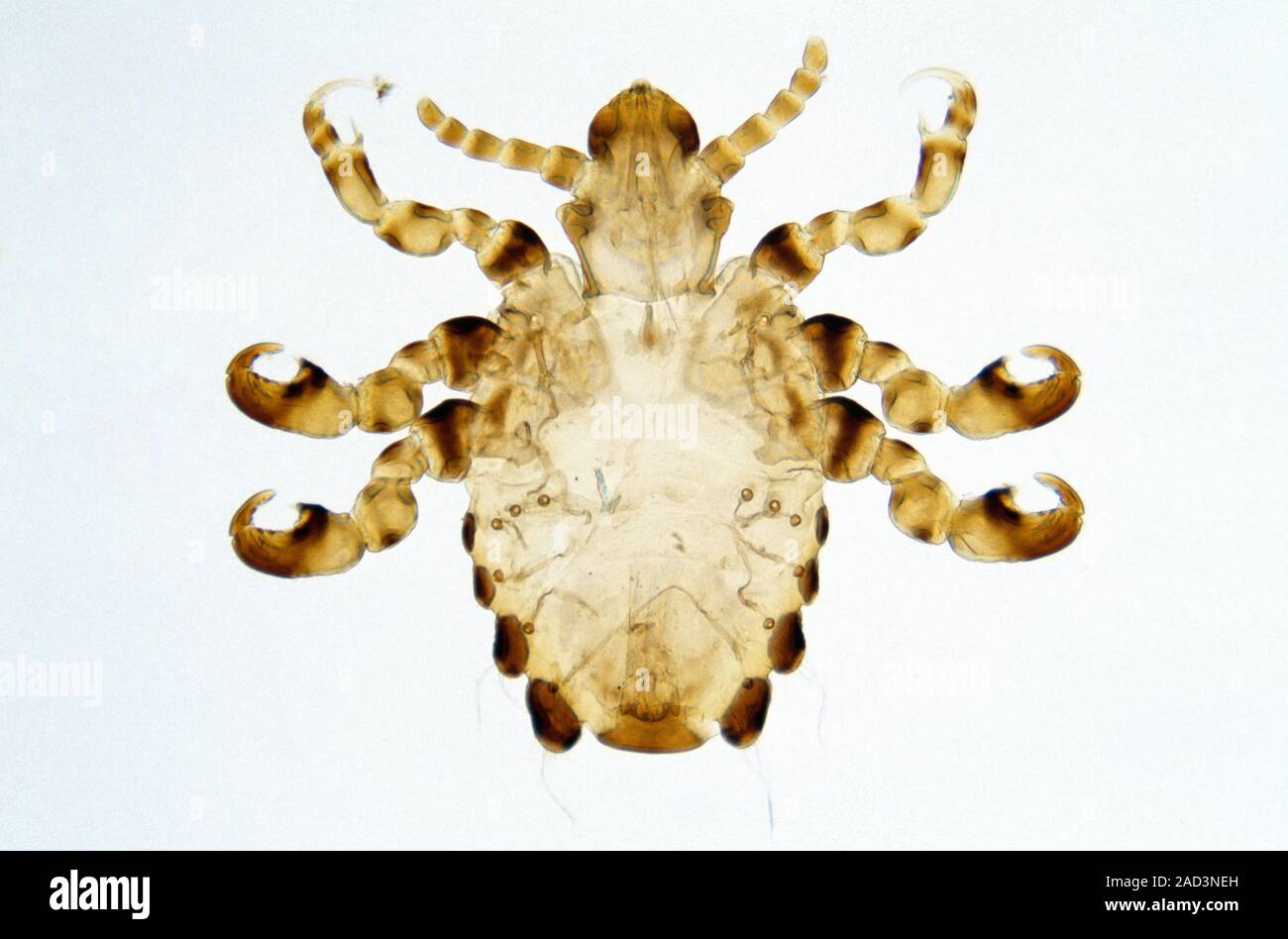 Light micrograph of a gorilla louse (Pthirus gorillae). The gorilla ...