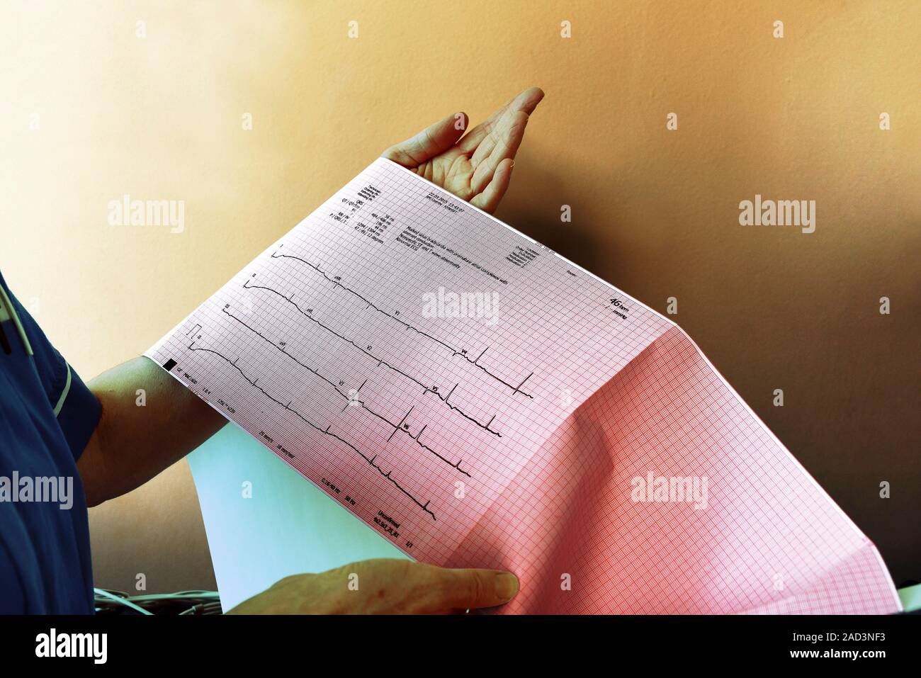 Electrocardiography test results. Healthcare professional looking at a ...