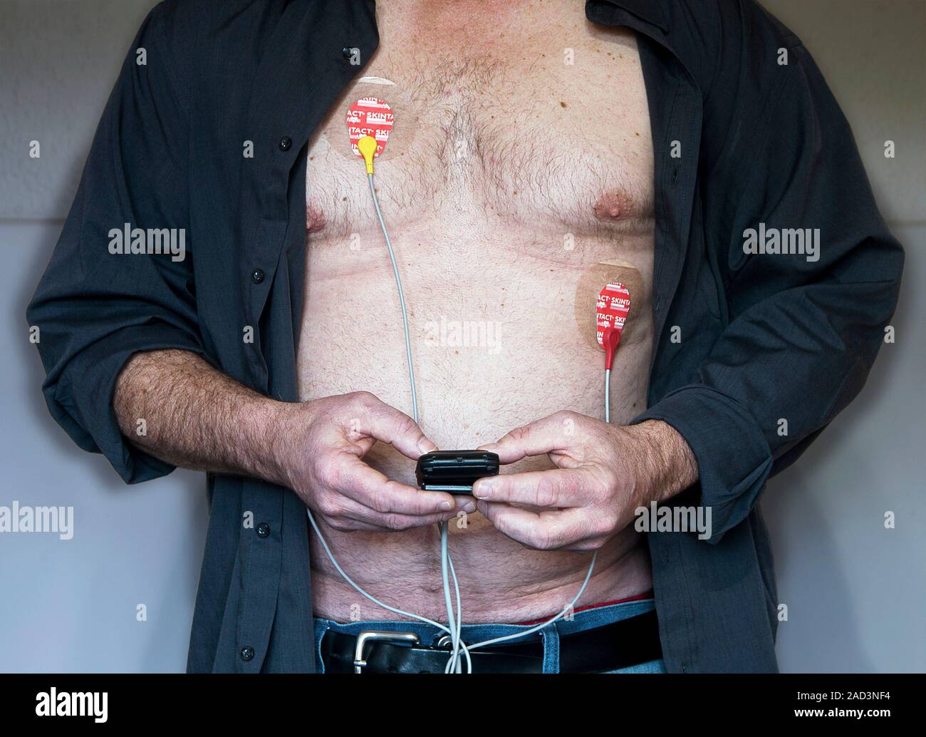 Portable ECG monitor being fitted. Patient who has been fitted with a ...