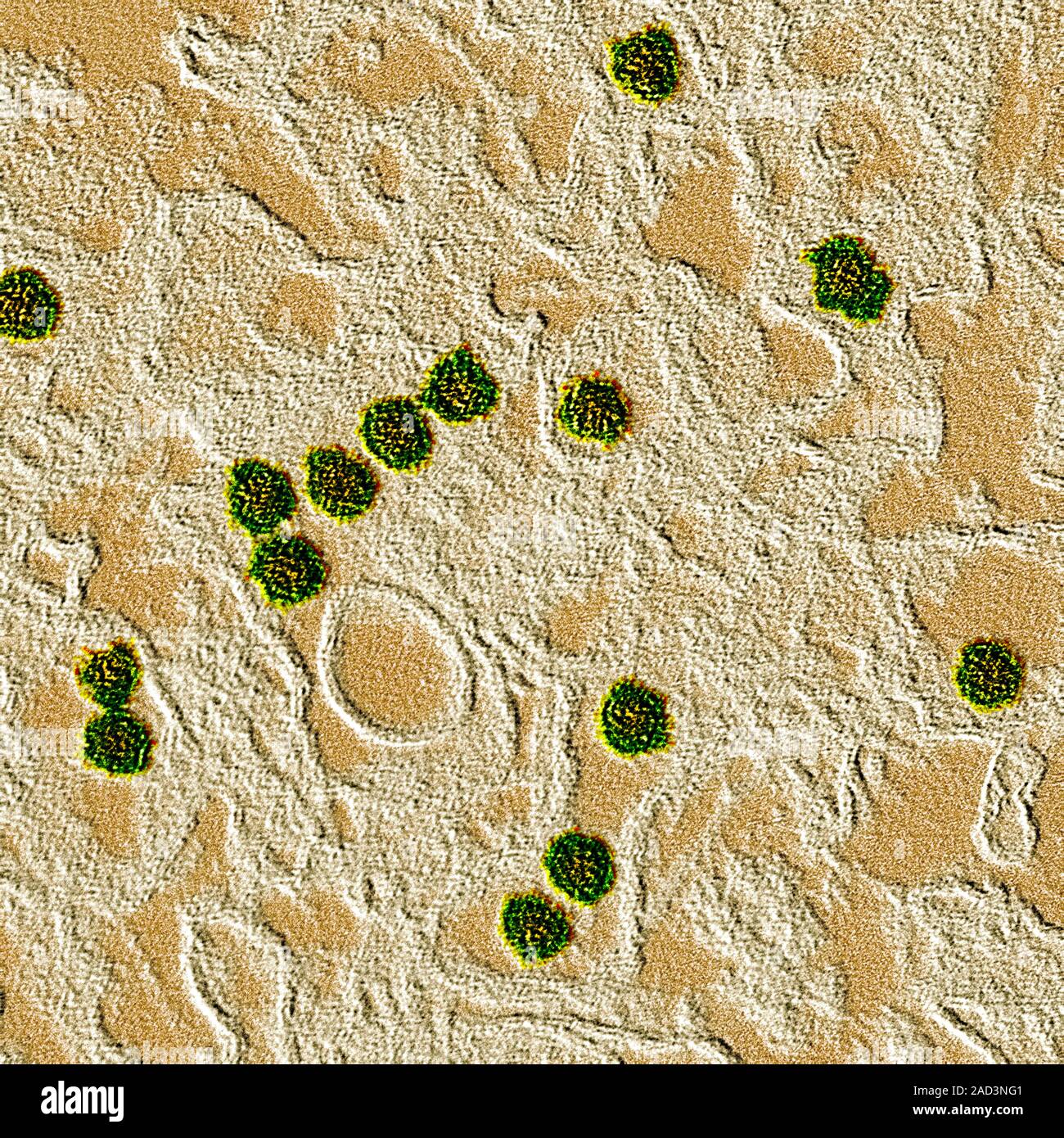 Coloured transmission electron micrograph (TEM) of Zika virus particles ...
