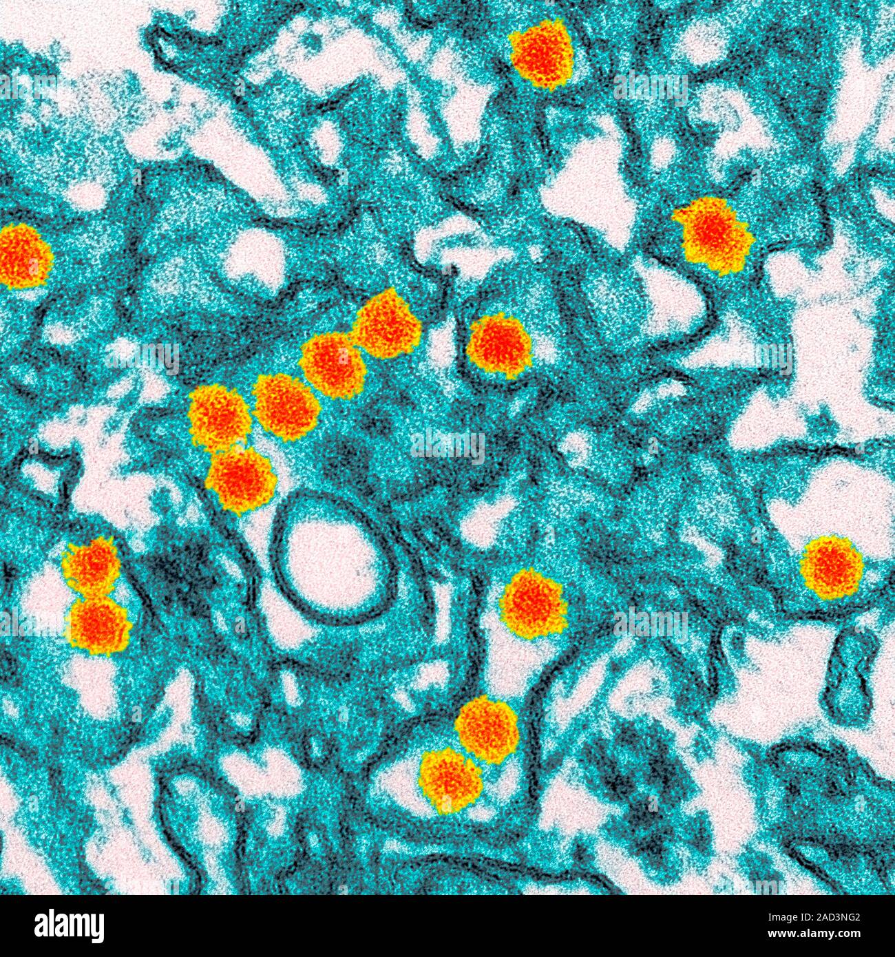 Coloured transmission electron micrograph (TEM) of Zika virus particles ...