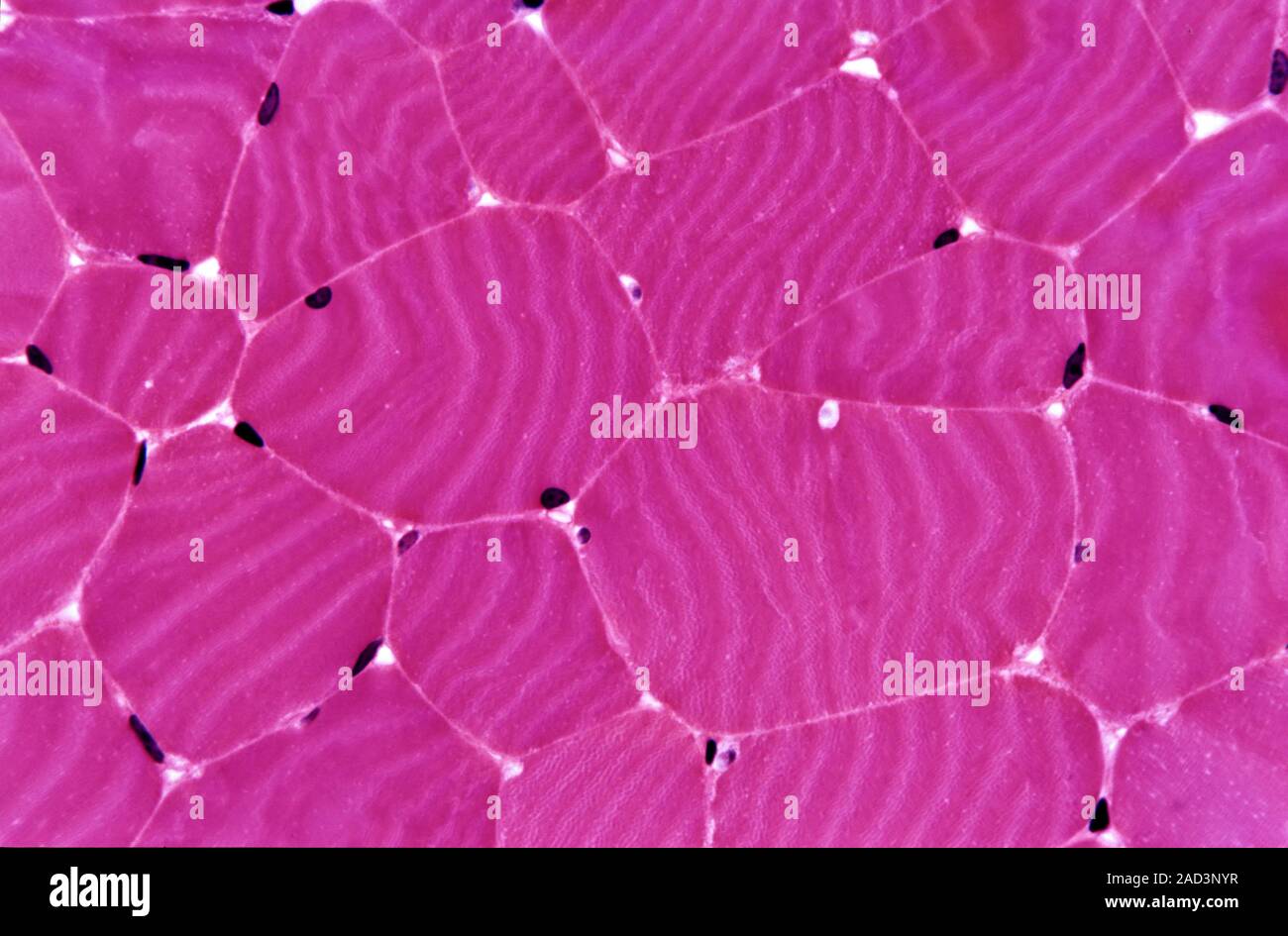 Light microscopy of a cross-sectioned skeletal muscle fibres. The cell ...