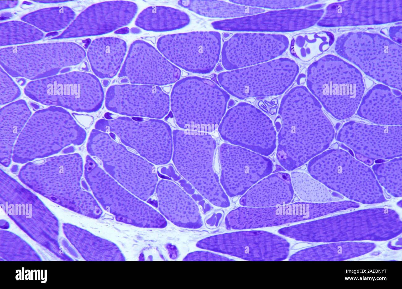 Light microscopy of skeletal muscle fibres mostly in cross-section. The ...