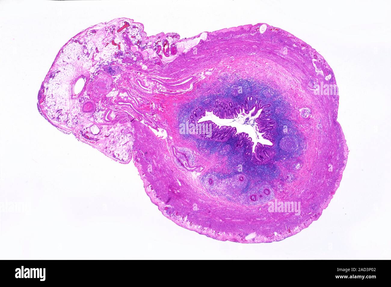 Light microscopy of cross-section of appendix. The appendix is a hollow ...