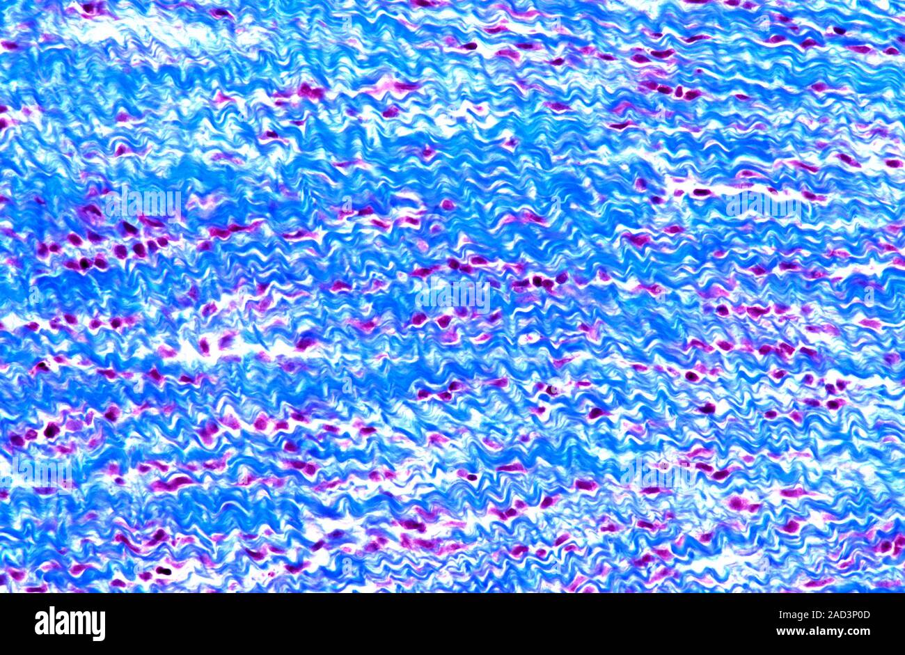 Light microscopy of a longitudinal section of a ligament. The wave-like ...