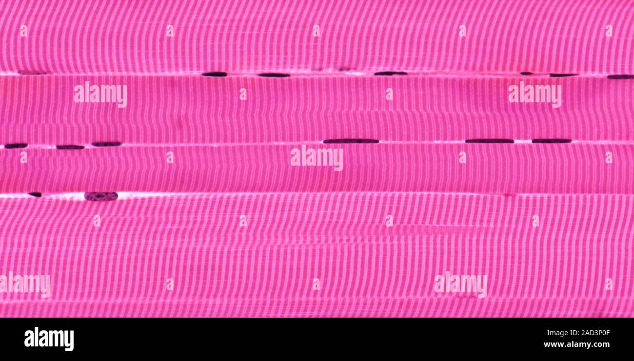 Light microscopy of skeletal muscle fibres seen in longitudinal section ...