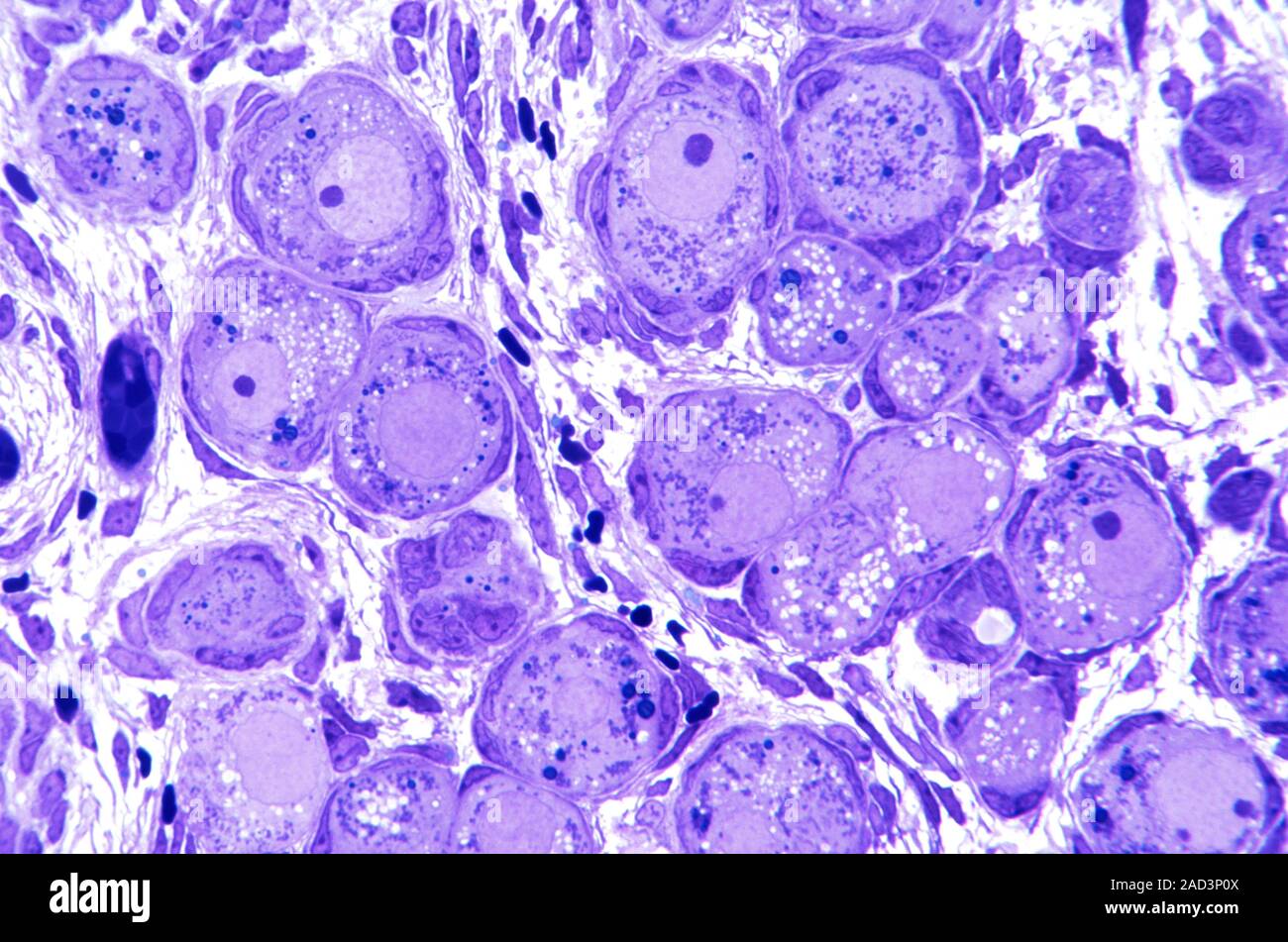 Light microscopy of the fetal ovary showing primordial follicles ...