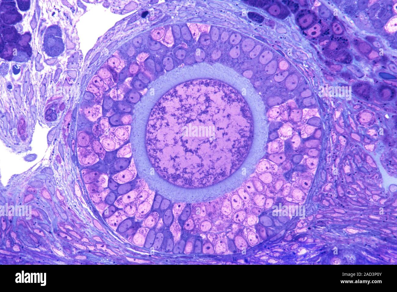 Light microscopy of a growing ovarian follicle, classified as a ...