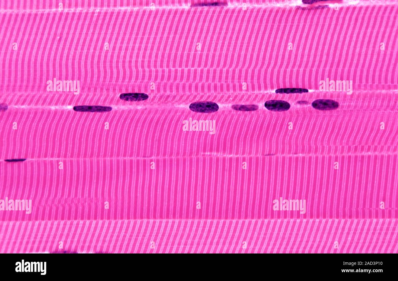 Light microscopy of skeletal muscle fibres seen in longitudinal section ...