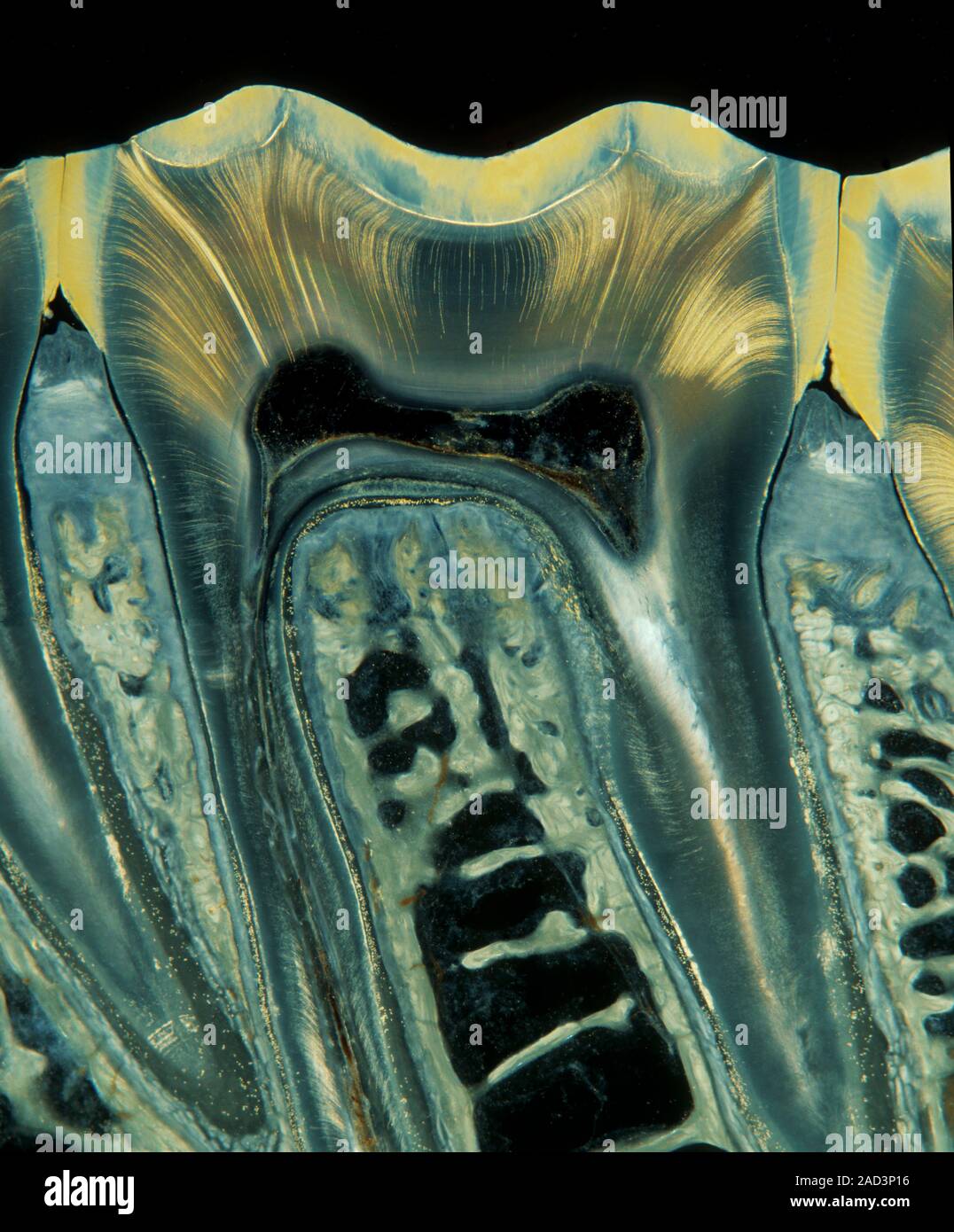 Light microscopy of a tooth. Plane polarized light micrograph of a ...