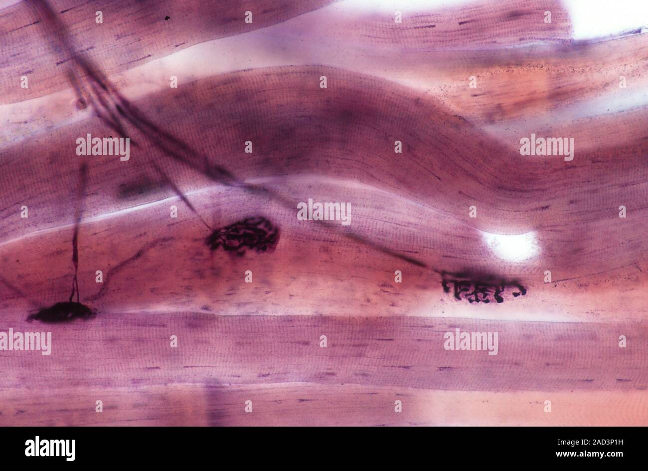 Light microscopy of motor nerve endings also known as motor nerve ...