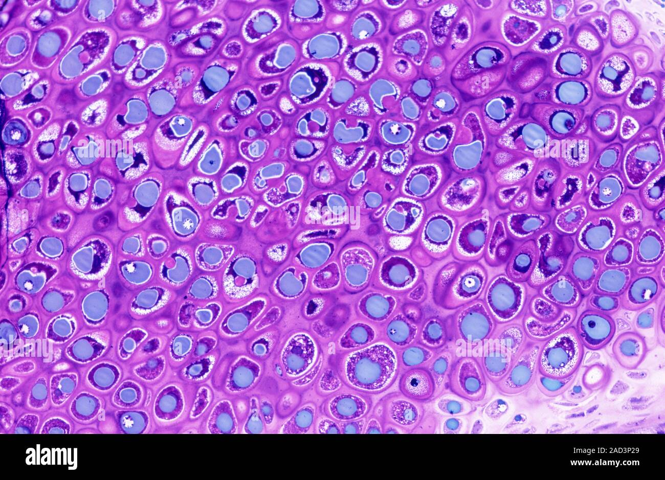 Light microscopy of cartilage showing chondrocytes surrounded by the ...