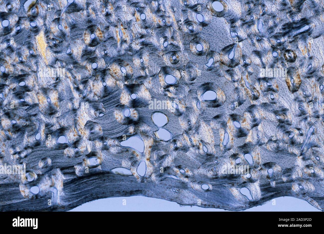 Polarized light micrograph of a unstained thick, ground section of ...