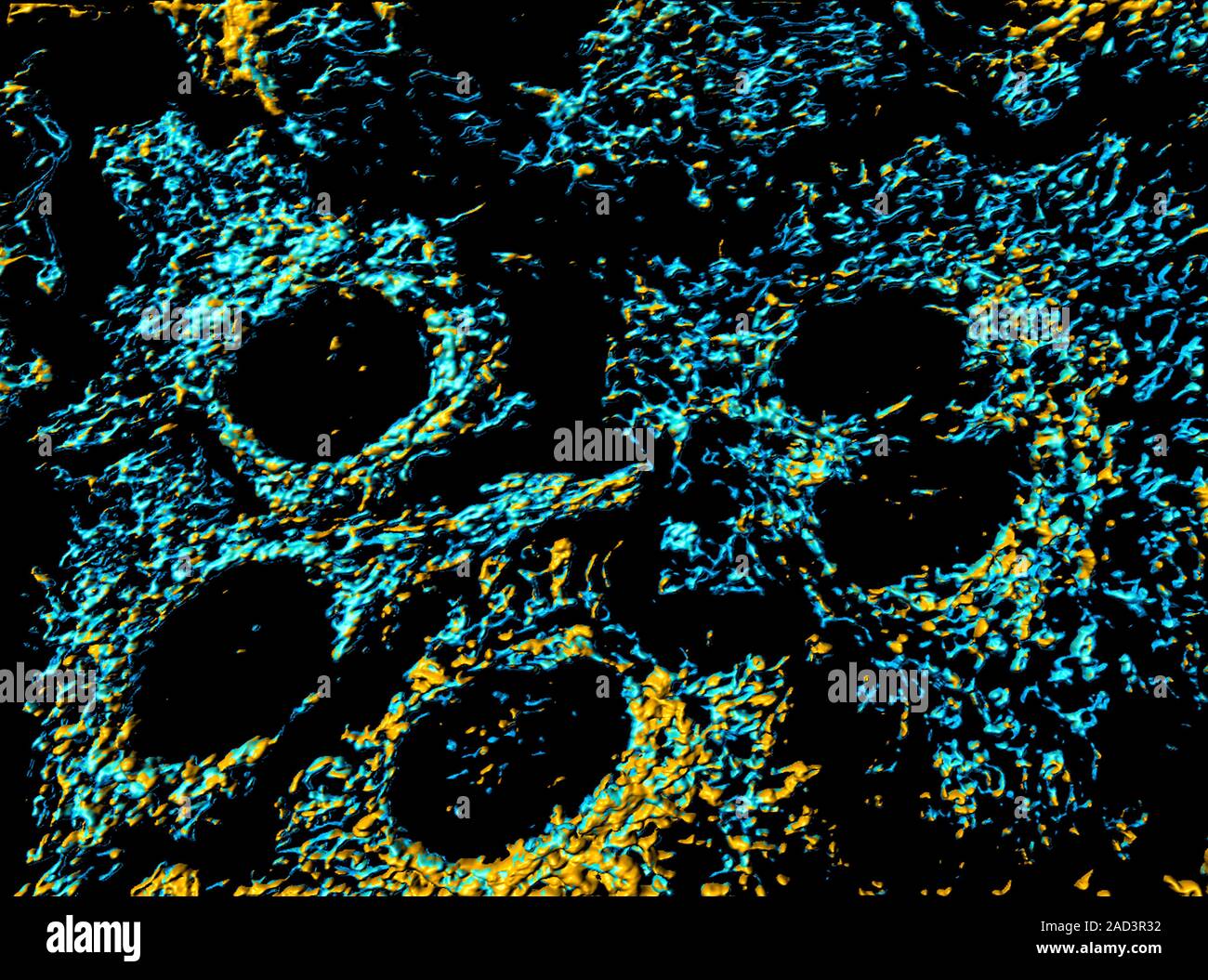 HeLa cells. Light micrograph of mitochondria in HeLa cells. HeLa cells ...