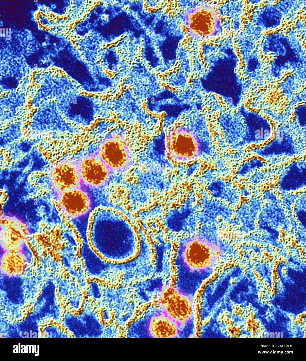 Coloured transmission electron micrograph (TEM) of Zika virus particles ...