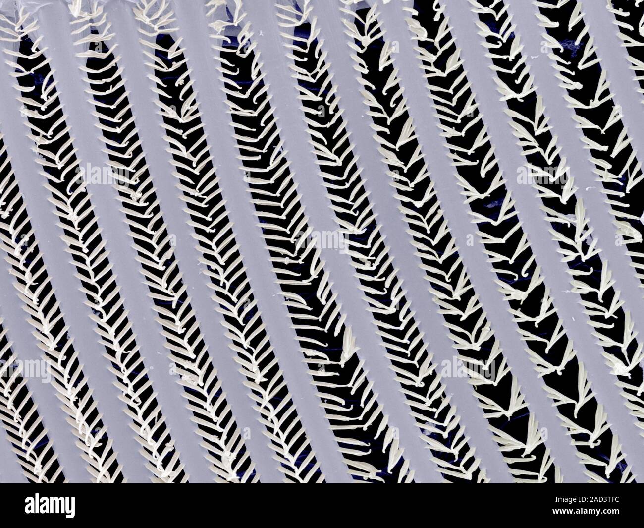 Water flea feeding filter. Coloured scanning electron micrograph (SEM ...