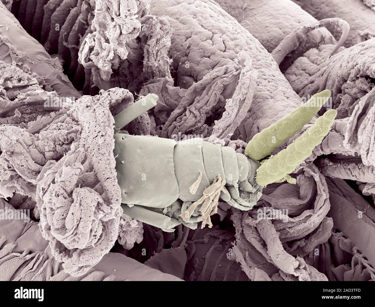 Parasitic copepod (Ergasillus sp.). Coloured scanning electron ...