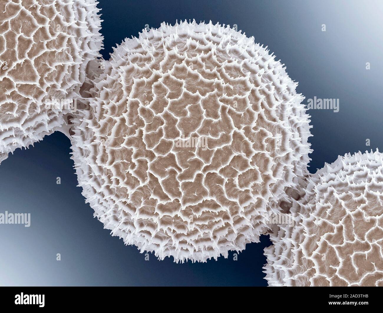 Fairy shrimp eggs. Coloured scanning electron micrograph (SEM) of the ...